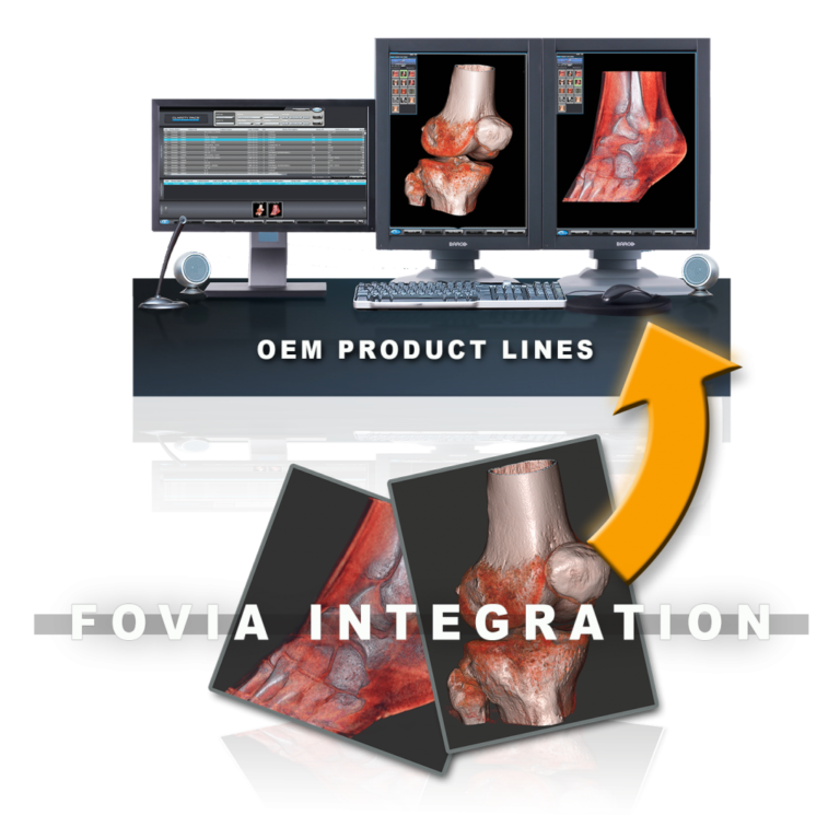 How to Integrate - Fovia