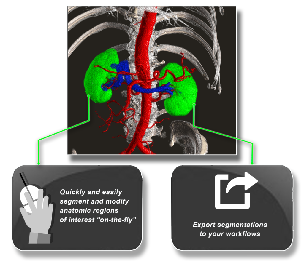 Interactive Segmentation for OEMs in Radiology via Imaging SDKs