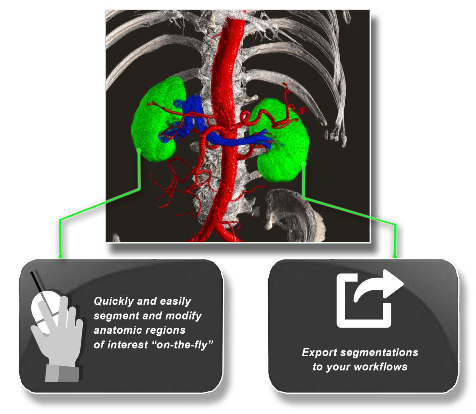 Interactive Segmentation for OEMs in Radiology via Imaging SDKs