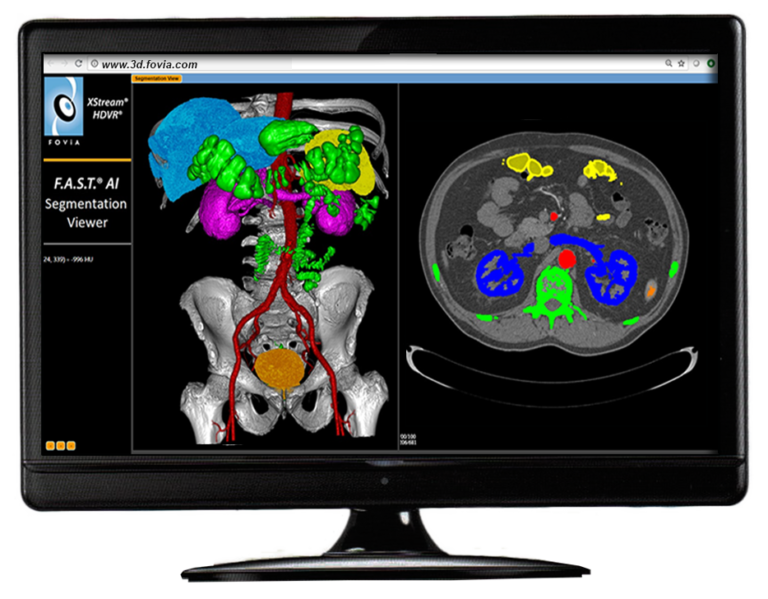 Interactive Segmentation for OEMs in Radiology via Imaging SDKs Interactive Segmentation for OEMs in Radiology via Imaging SDKs