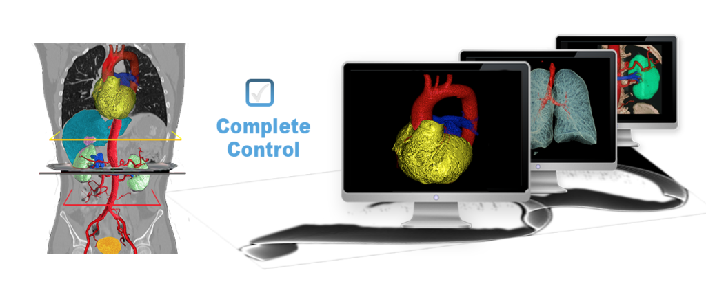 Interactive Segmentation for OEMs in Radiology via Imaging SDKs